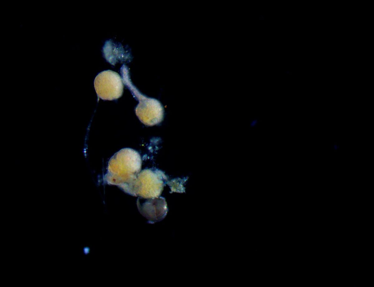 Photo Gallery - The Real Immortal Jellyfish